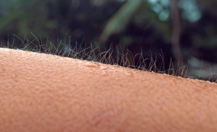 HAS YOUR PILOERECTION BEEN SHOWING? - The Westsider